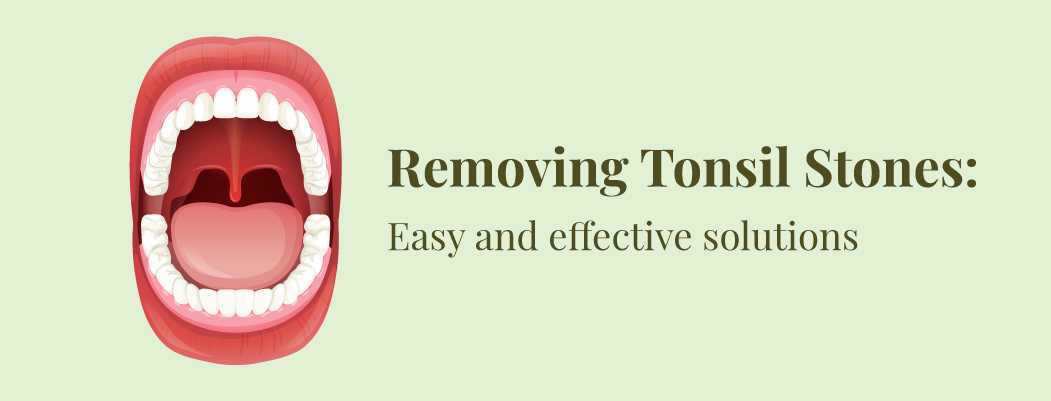 7 Home Remedies: How To Get Rid Of Tonsil Stones